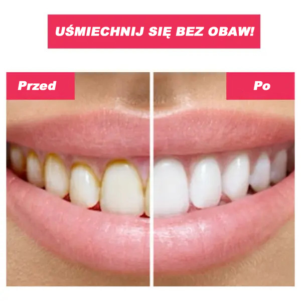 Zobna prha za odstranjevanje zobnih oblog | TOOTHCLEANSO – Toprabat.si